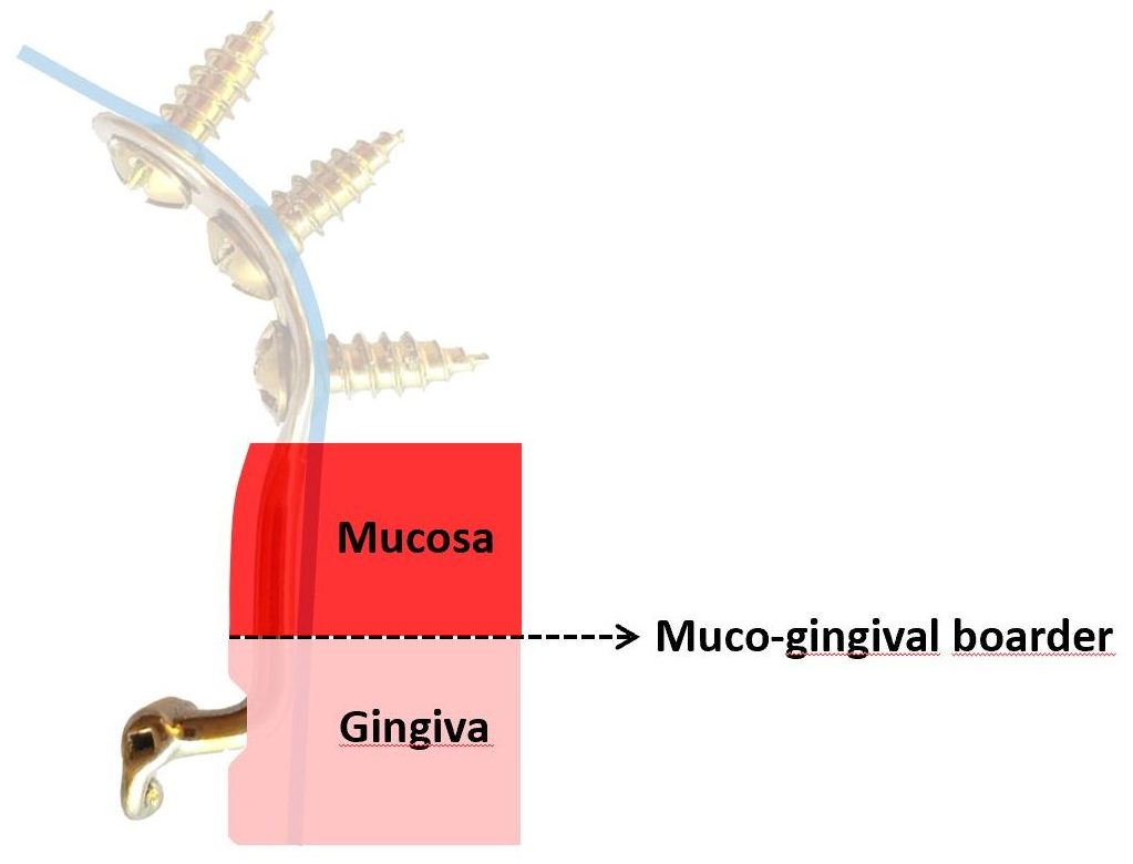 Surgeon – Less Chin